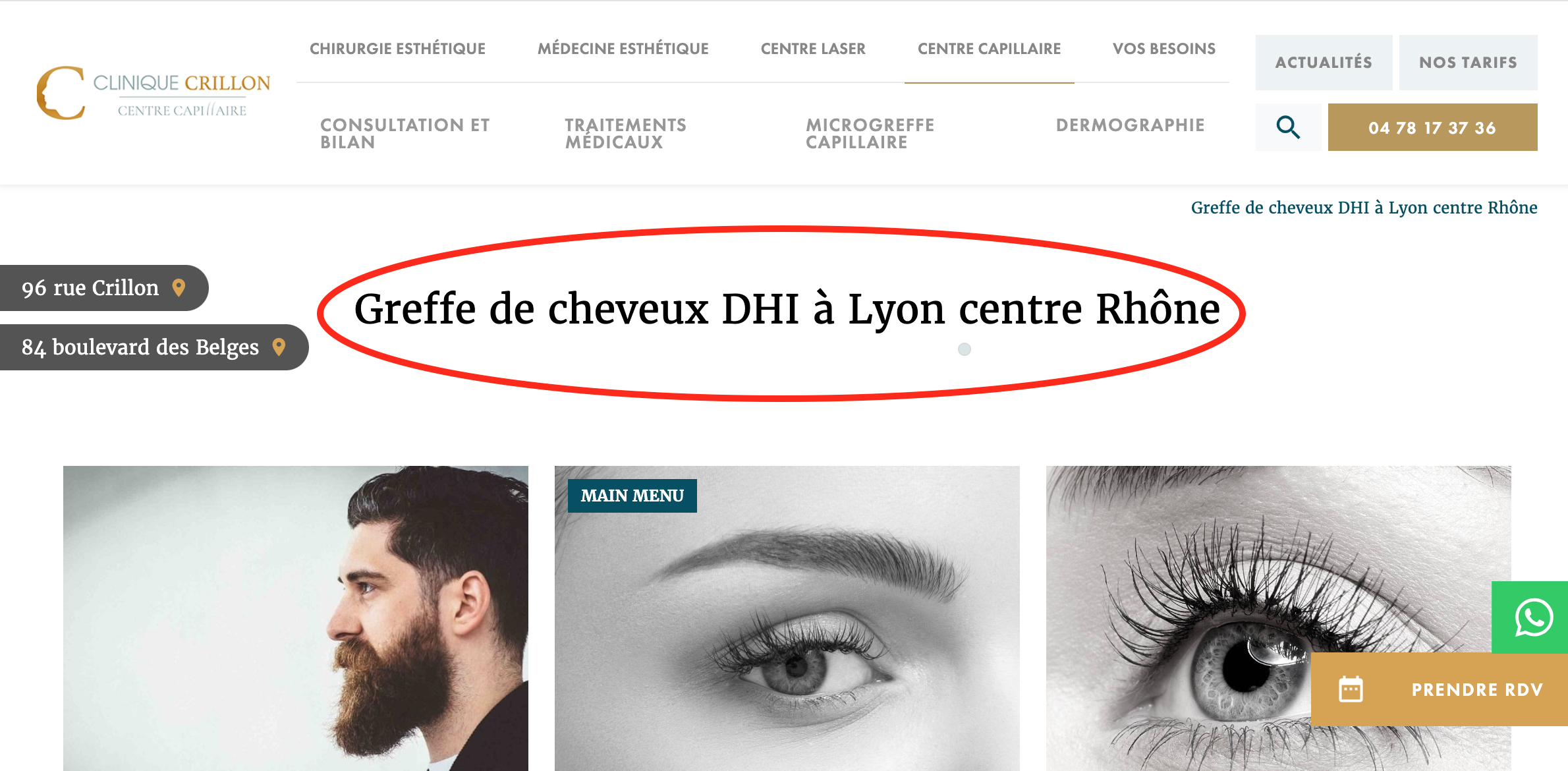 Ces cliniques françaises qui prétendent utiliser la méthode DHI | DHI ...